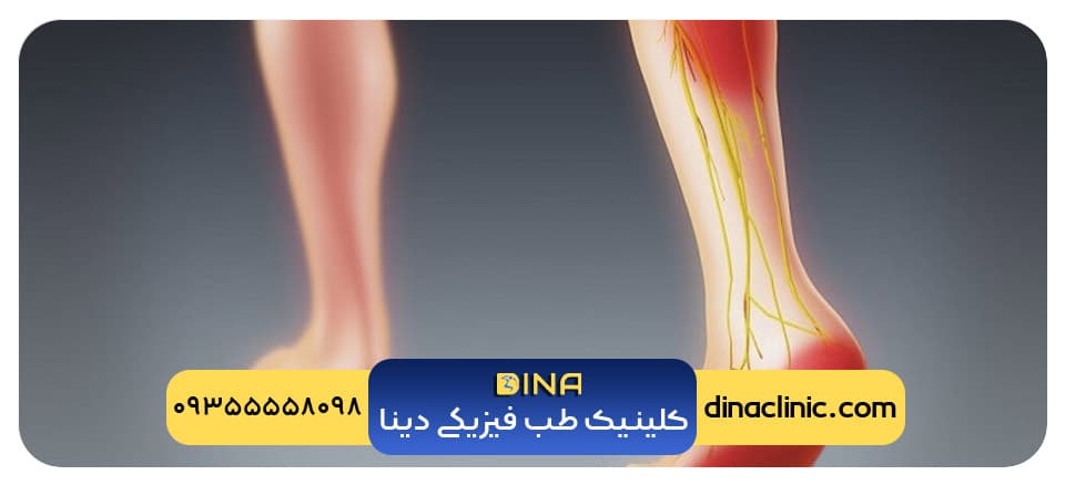 علت درد پا چیست و چگونه در خانه درمان می‌شود؟ | کلینیک دینا